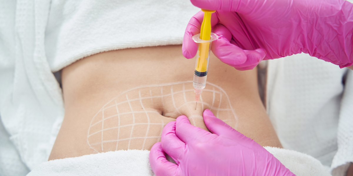 BNLS FAT BURN注射で脂肪を溶かす！美容クリニックの人気施術を解説 | 札幌の医療痩身専門 ころもクリニック